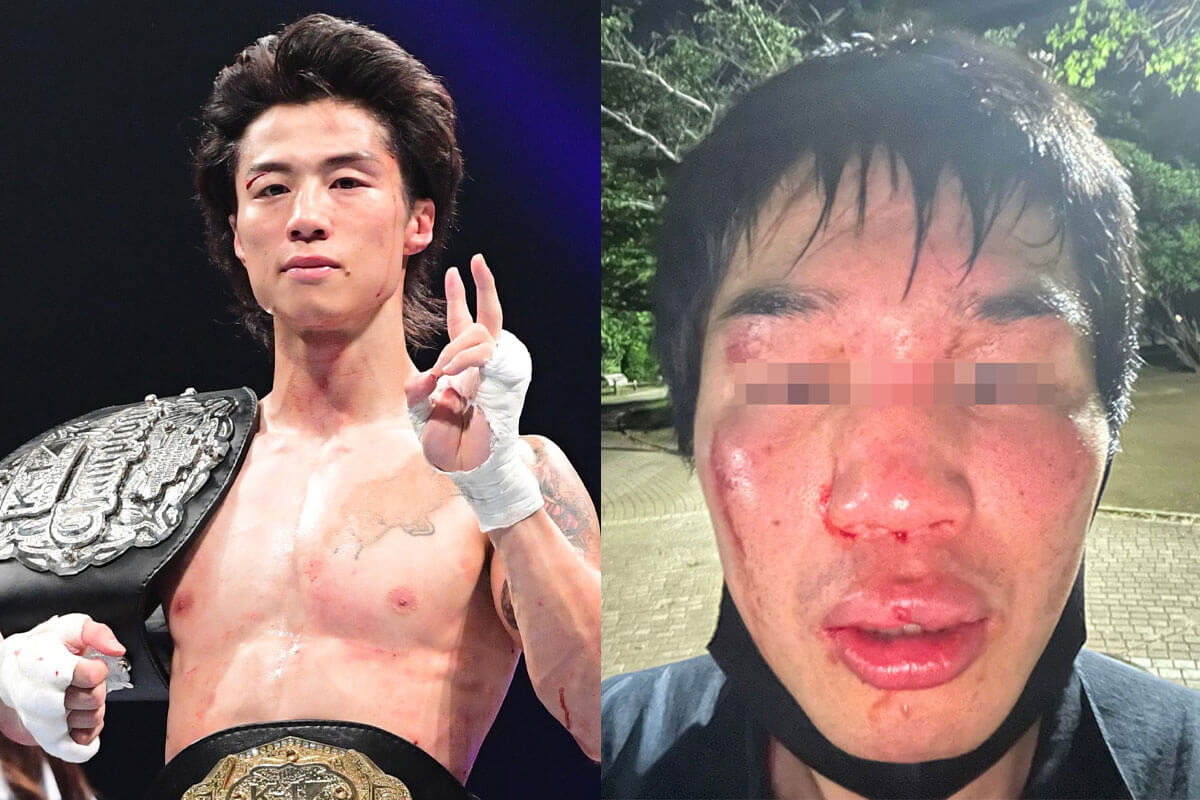 “不起訴でも許せない” K-1チャンピオンの「身の毛もよだつ暴行動画」に批判殺到 K-1プロデューサーに就任した須藤元気氏に見解を質したが「返答なし」 | デイリー新潮